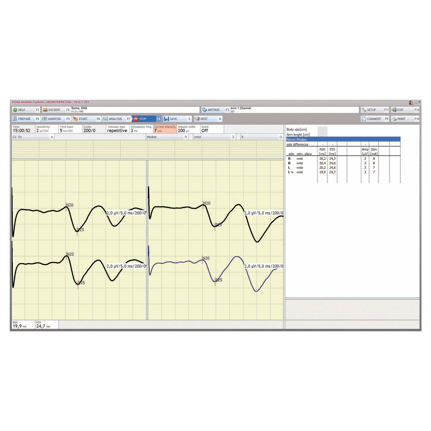 Electromiograf cu 2 sau 4 canale NEUROWERK EMG » Intro.ro